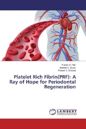 Platelet Rich Fibrin(PRF): A Ray of Hope for Periodontal Regeneration ...