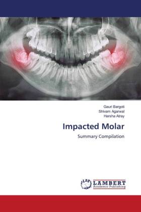 Impacted Molar von Gauri Bargoti, Shivam Agarwal und Harsha Atray ...