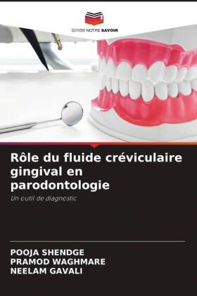 Rôle du fluide créviculaire gingival en parodontologie von POOJA ...