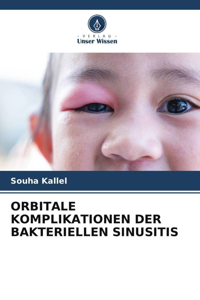 ORBITALE KOMPLIKATIONEN DER BAKTERIELLEN SINUSITIS - Michaelsbund