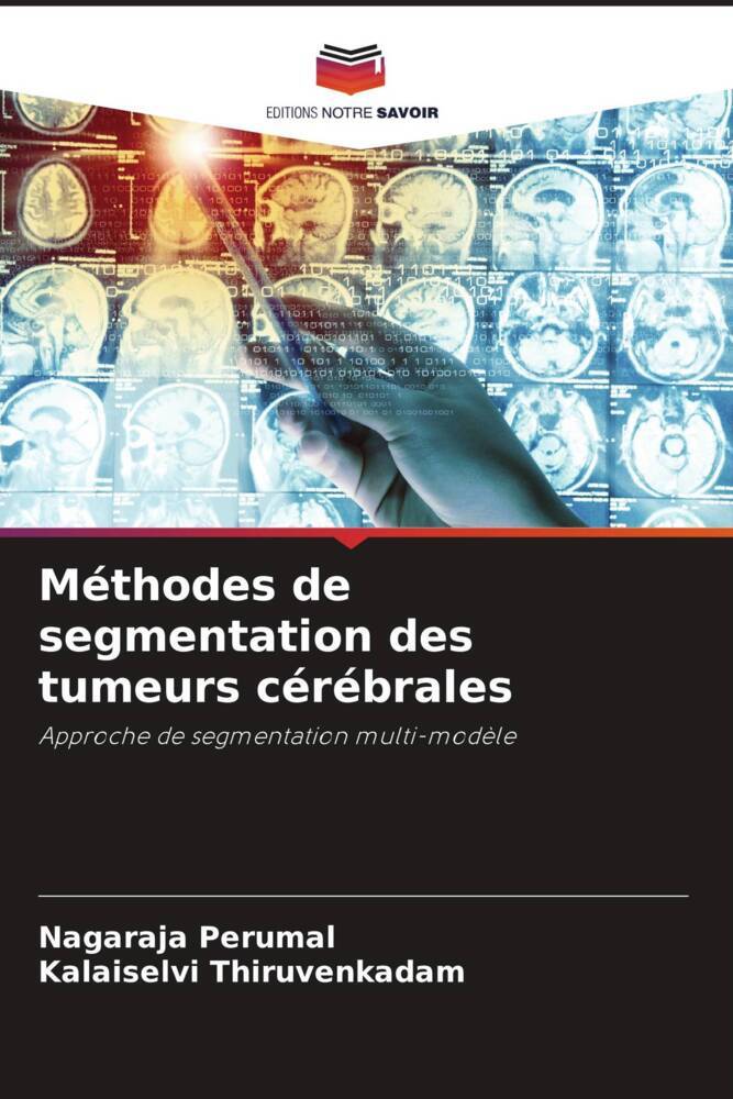 Méthodes de segmentation des tumeurs cérébrales - Michaelsbund